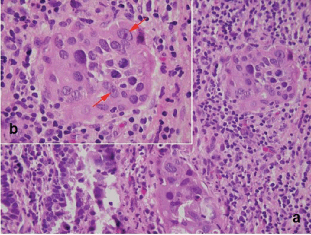The Pap Smear (Chapter 1) - Differential Diagnosis in Cytopathology