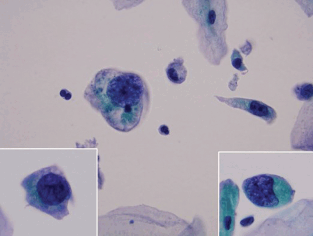 The Pap Smear (Chapter 1) - Differential Diagnosis in Cytopathology