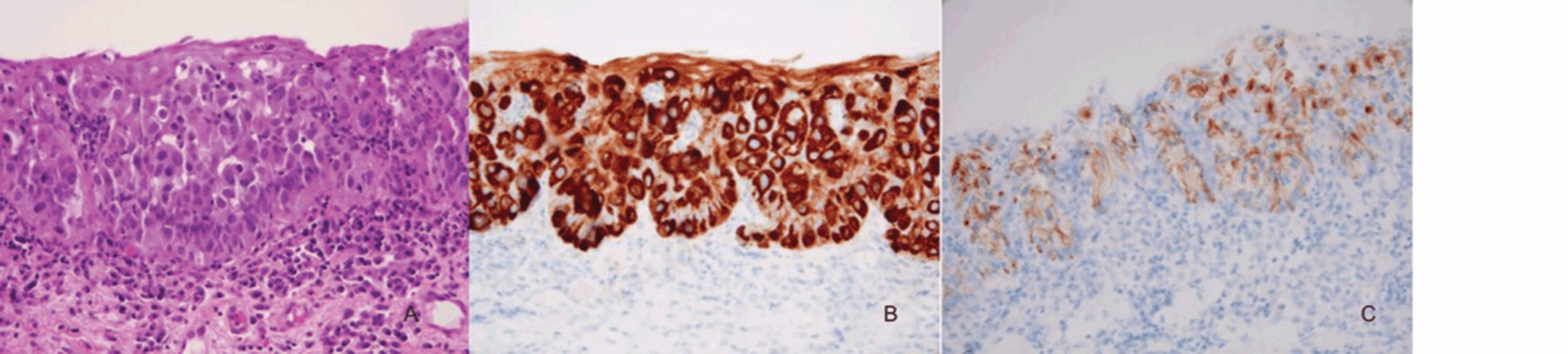 The Pap Smear (Chapter 1) - Differential Diagnosis in Cytopathology