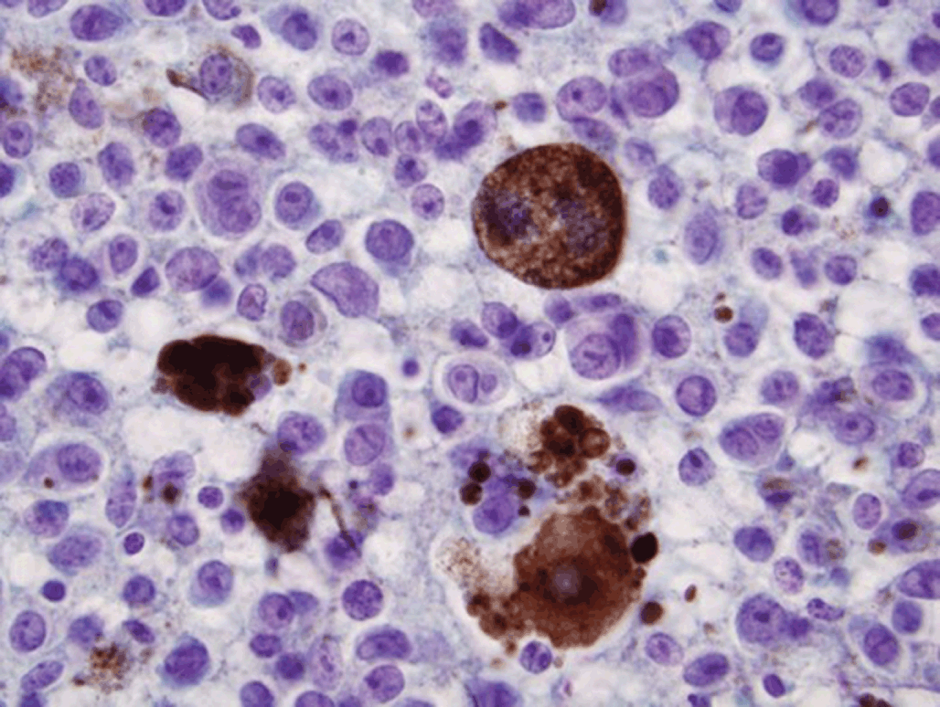 The Pap Smear (Chapter 1) - Differential Diagnosis in Cytopathology