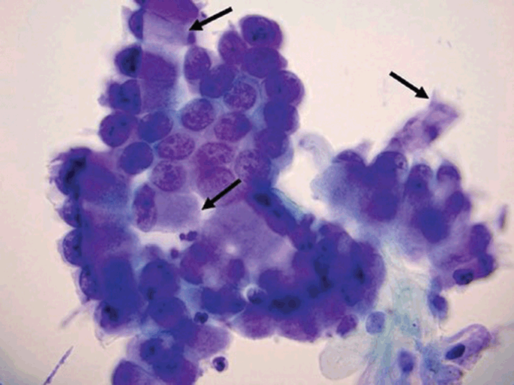 The Pap Smear (Chapter 1) - Differential Diagnosis in Cytopathology