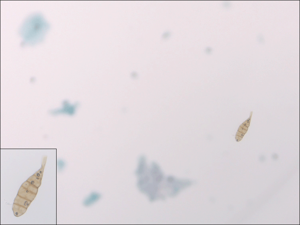 The Pap Smear (Chapter 1) - Differential Diagnosis in Cytopathology