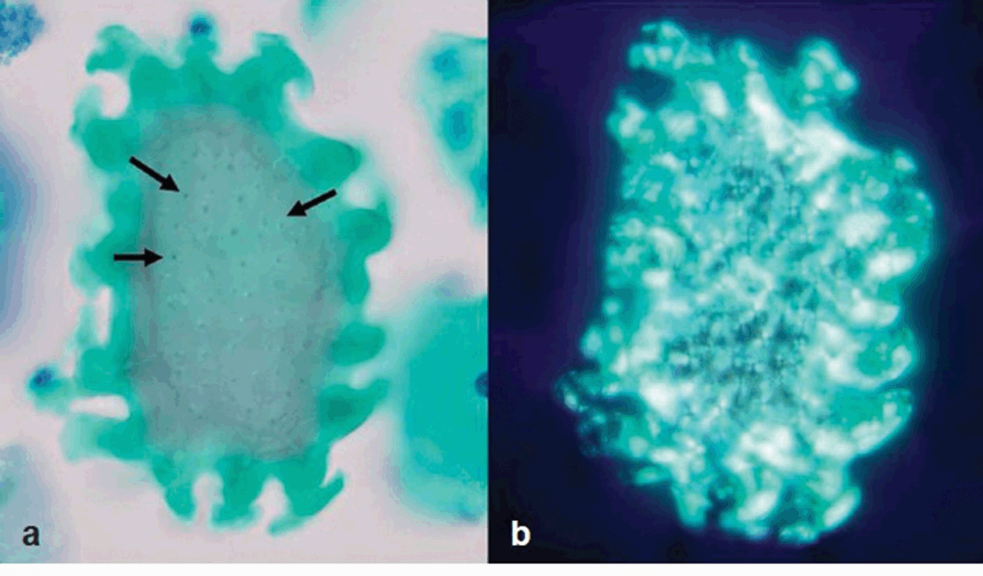 The Pap Smear (Chapter 1) - Differential Diagnosis in Cytopathology