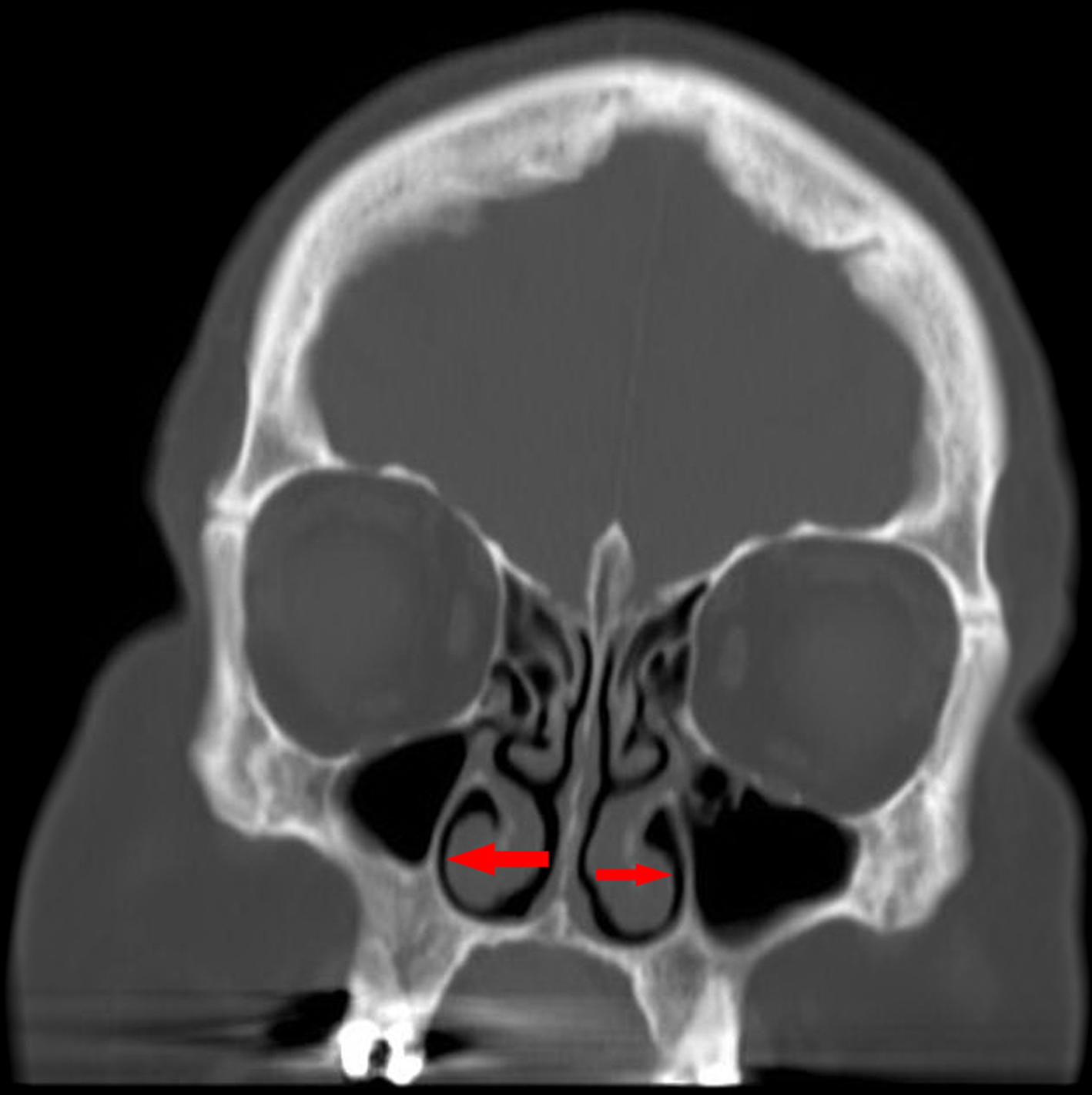 Physiological changes in the size of the septal swell body correlate ...
