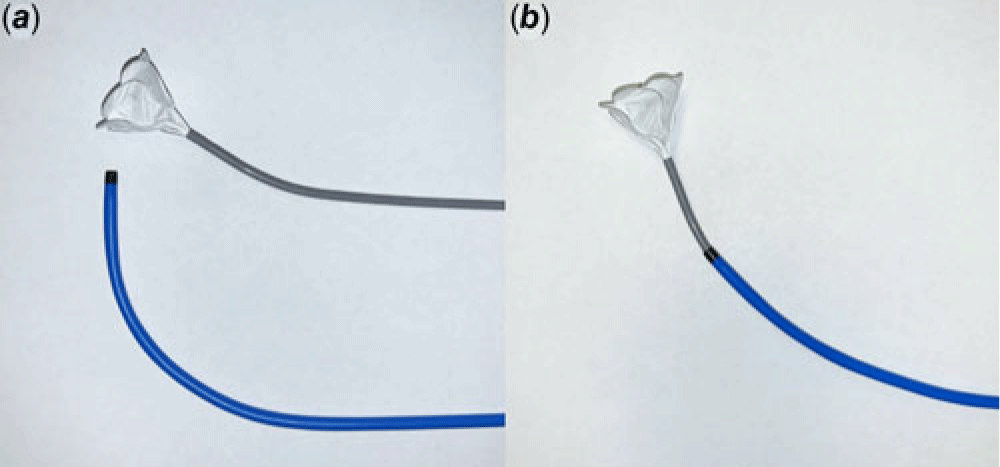 Use of Mullins sheath to prevent prolapse of Gore Cardioform ASD ...