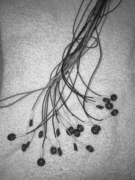 Introduction (Chapter 1) - How to Read an EEG