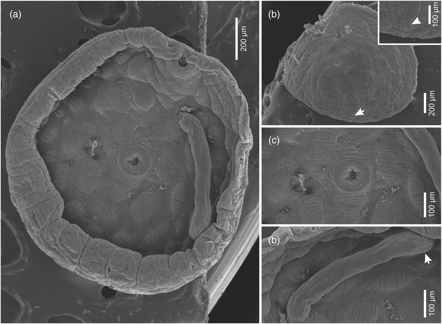 A new species of Dermadena (Digenea: Lepocreadiidae) from the stone ...