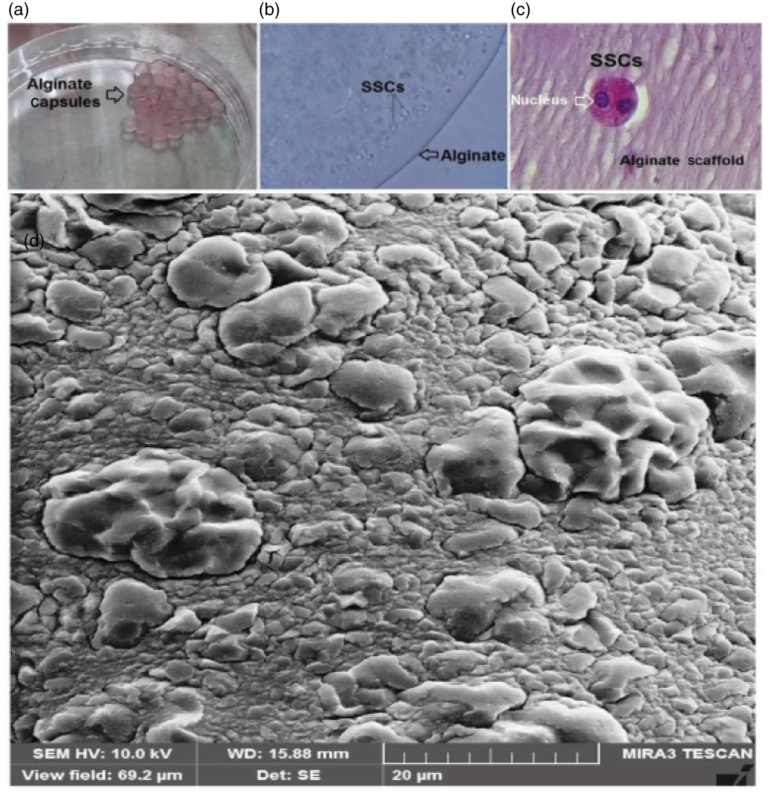 Use of alginate hydrogel to improve long-term 3D culture of spermatogonial stem cells: stemness ...