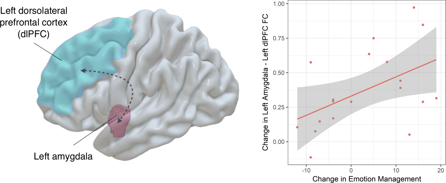 Functional connectivity associated with improvement in emotion ...