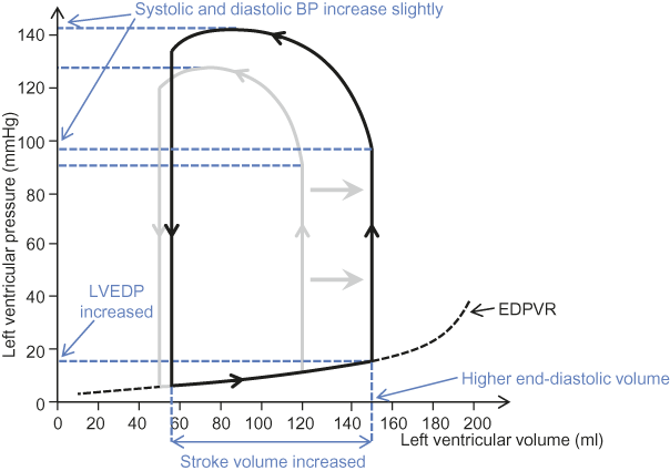 Cardiac Pressure Volume Curve