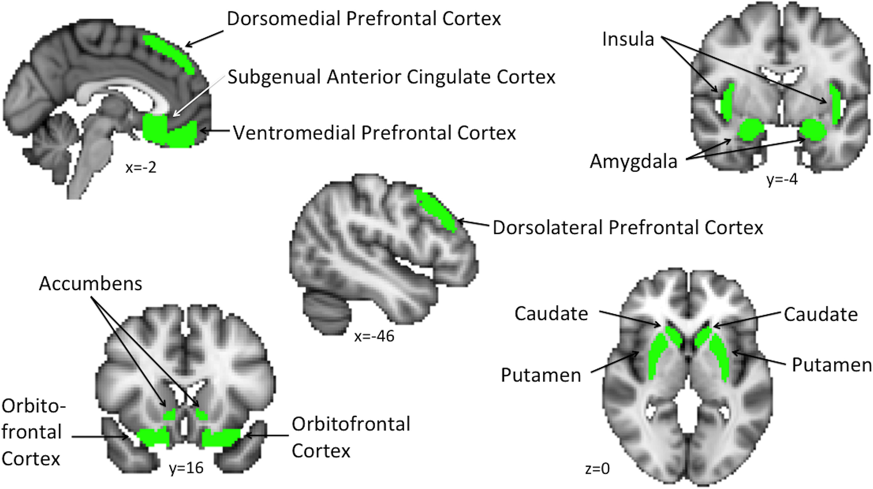 Functional connectivity based brain signatures of behavioral regulation ...