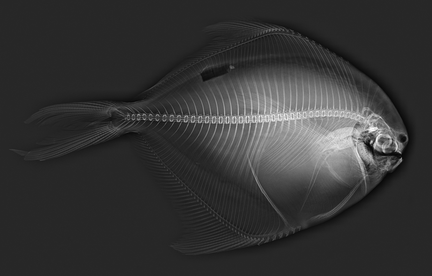 First record of vertebral anomalies in some members of the genus Pampus ...
