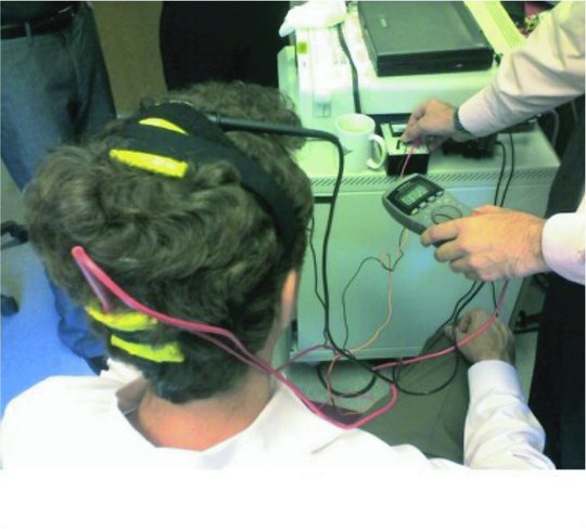 Transcranial Direct Current Stimulation Transcranial Direct Current Stimulation