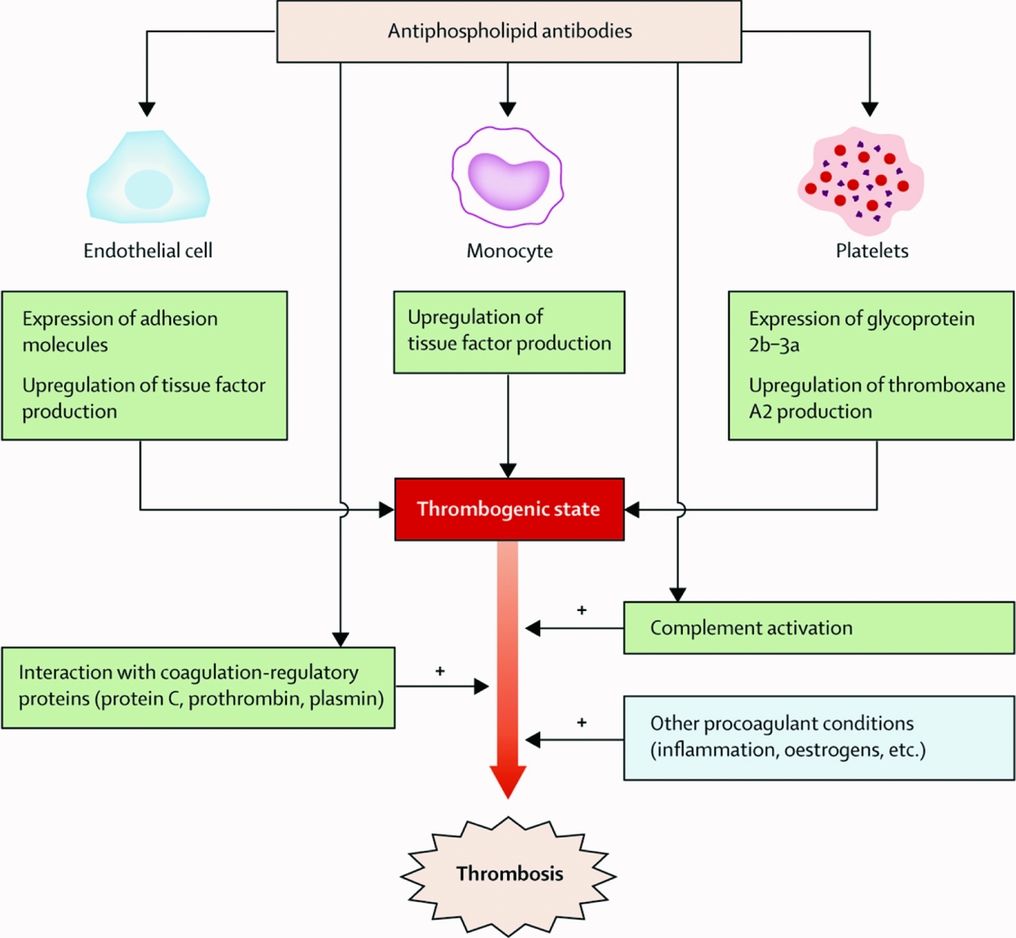 OBSTETRIC ANTIPHOSPHOLIPID SYNDROME - A REVIEW | Fetal and Maternal ...