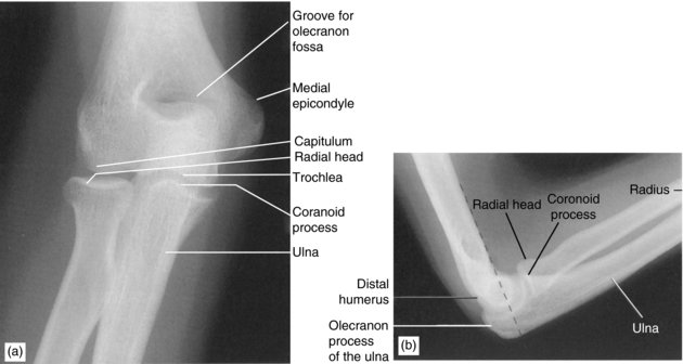 Trochlea Kerbe Humerus
