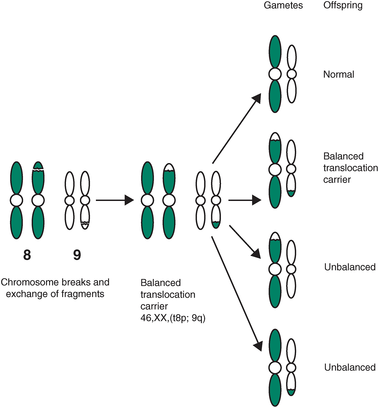Translocation Mutation Down Syndrome