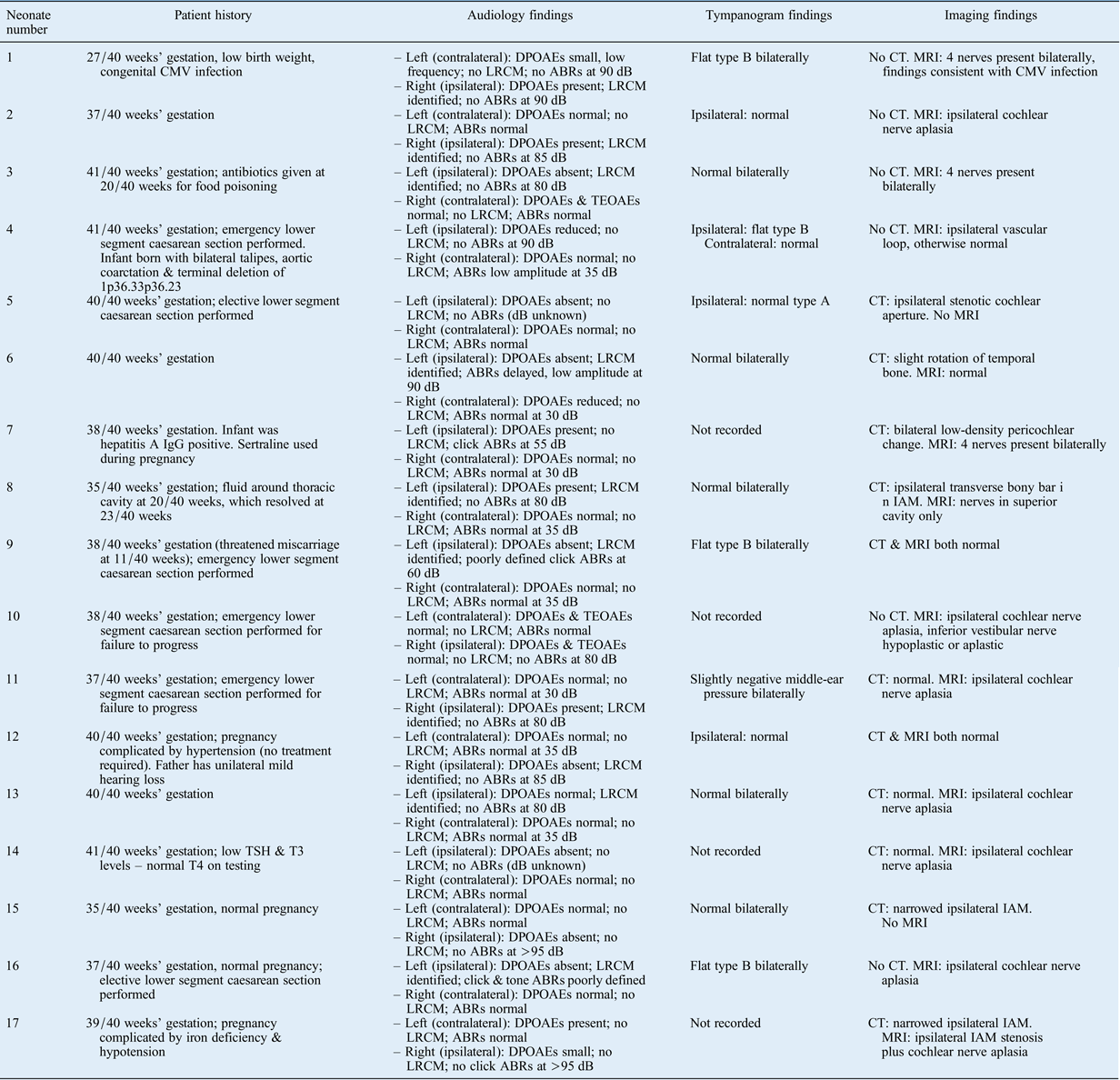 Unilateral auditory neuropathy spectrum disorder: retrocochlear lesion ...