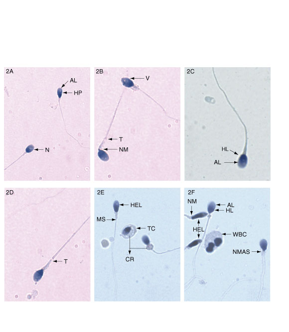 Sperm Microscope Slide Labeled
