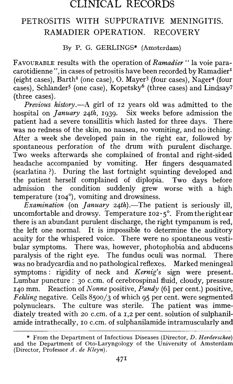 Petrositis with Suppurative Meningitis. Ramadier Operation. Recovery ...