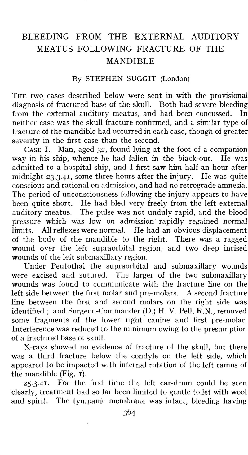 Bleeding from the External Auditory Meatus Following Fracture of the ...