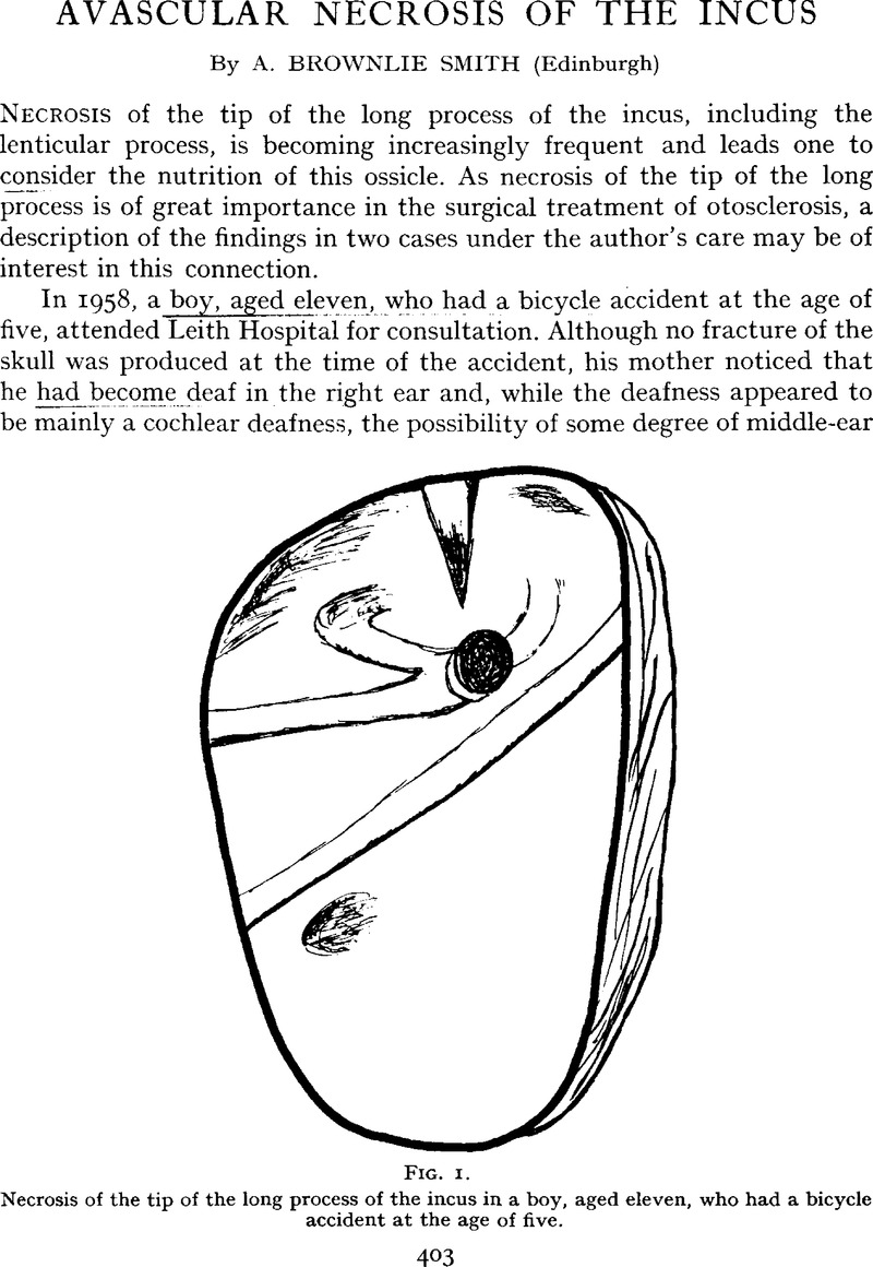 Avascular Necrosis of the Incus | The Journal of Laryngology & Otology ...