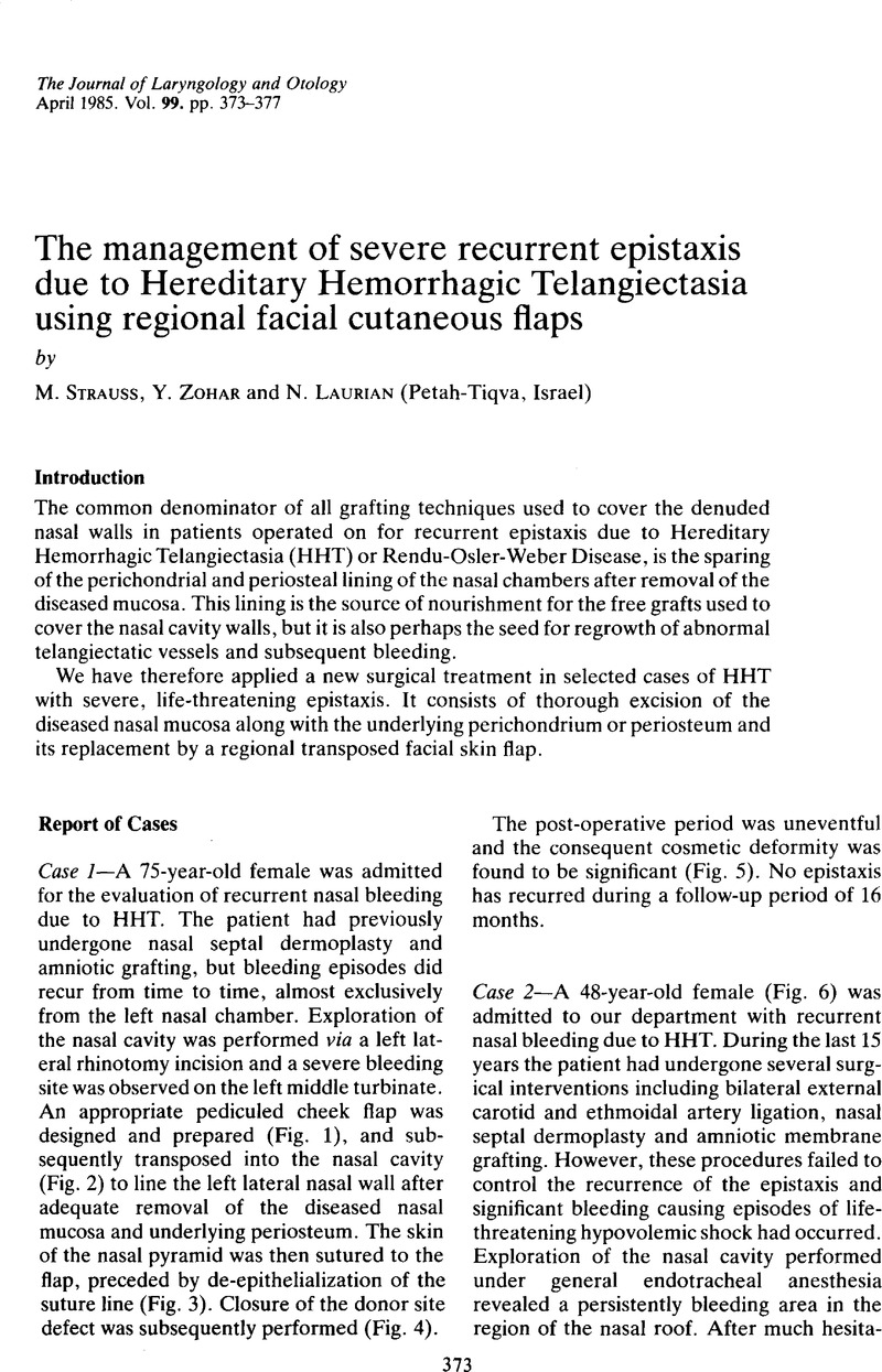 The management of severe recurrent epistaxis due to Hereditary ...