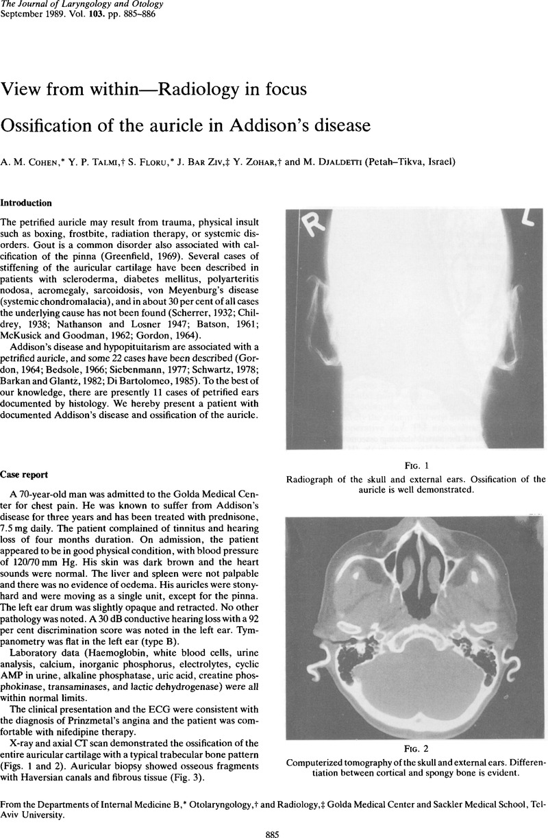 Ossification of the auricle in Addison's disease | The Journal of ...