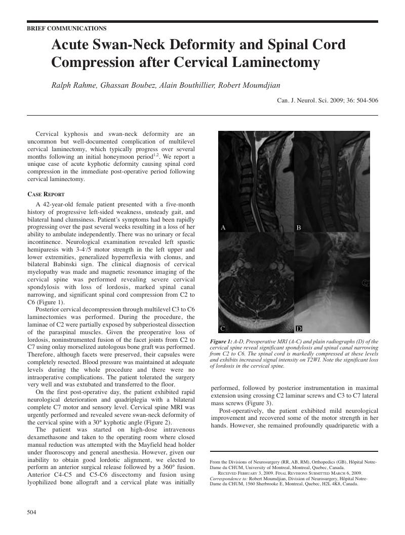 Acute Swan-Neck Deformity and Spinal Cord Compression after Cervical ...