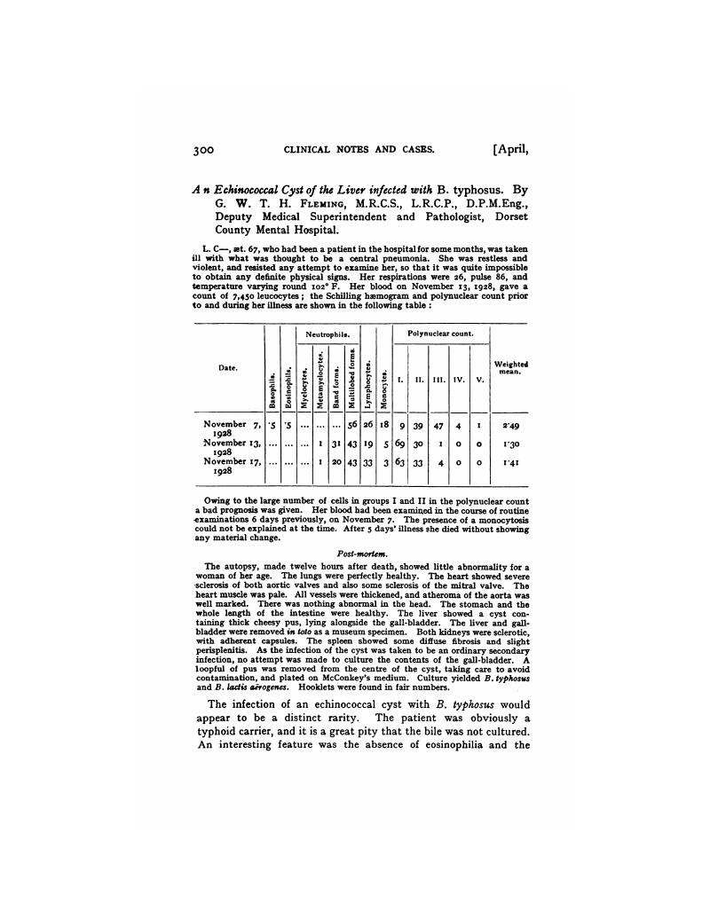 An Echinococcl Cyst of the Liver infected with B. typhosus | Journal of ...
