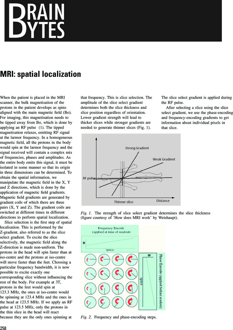 MRI: spatial localization | Acta Neuropsychiatrica | Cambridge Core