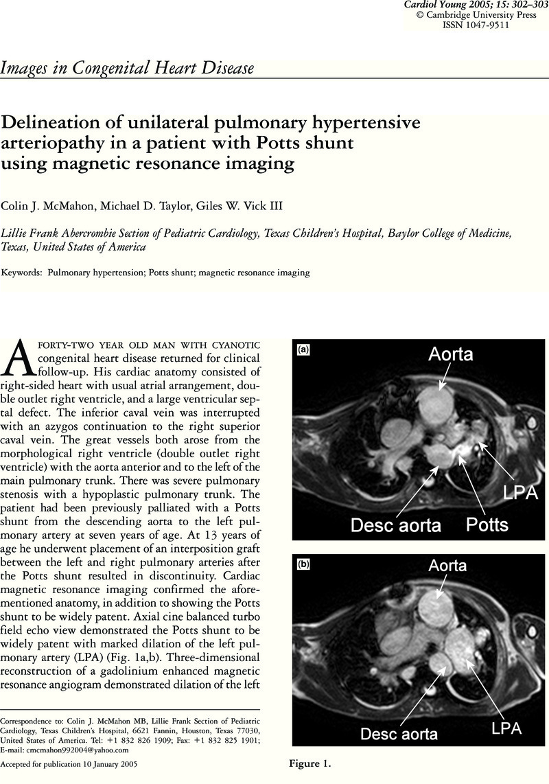 Delineation of unilateral pulmonary hypertensive arteriopathy in a ...