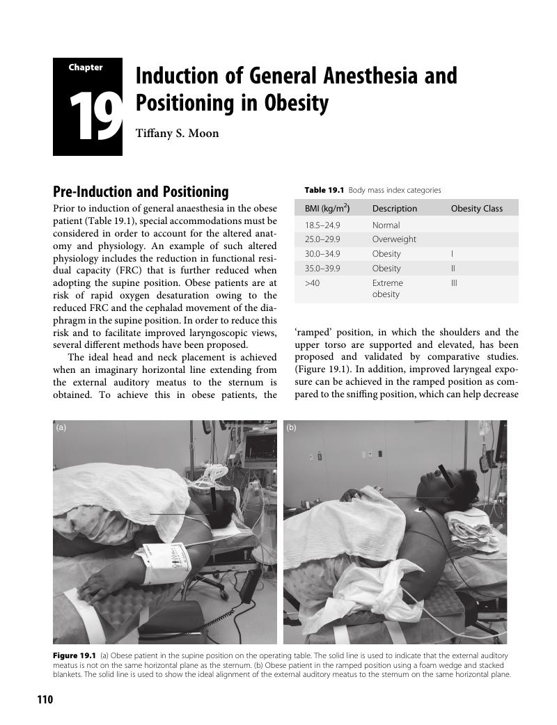 Induction of General Anesthesia and Positioning in Obesity (Chapter 19 ...